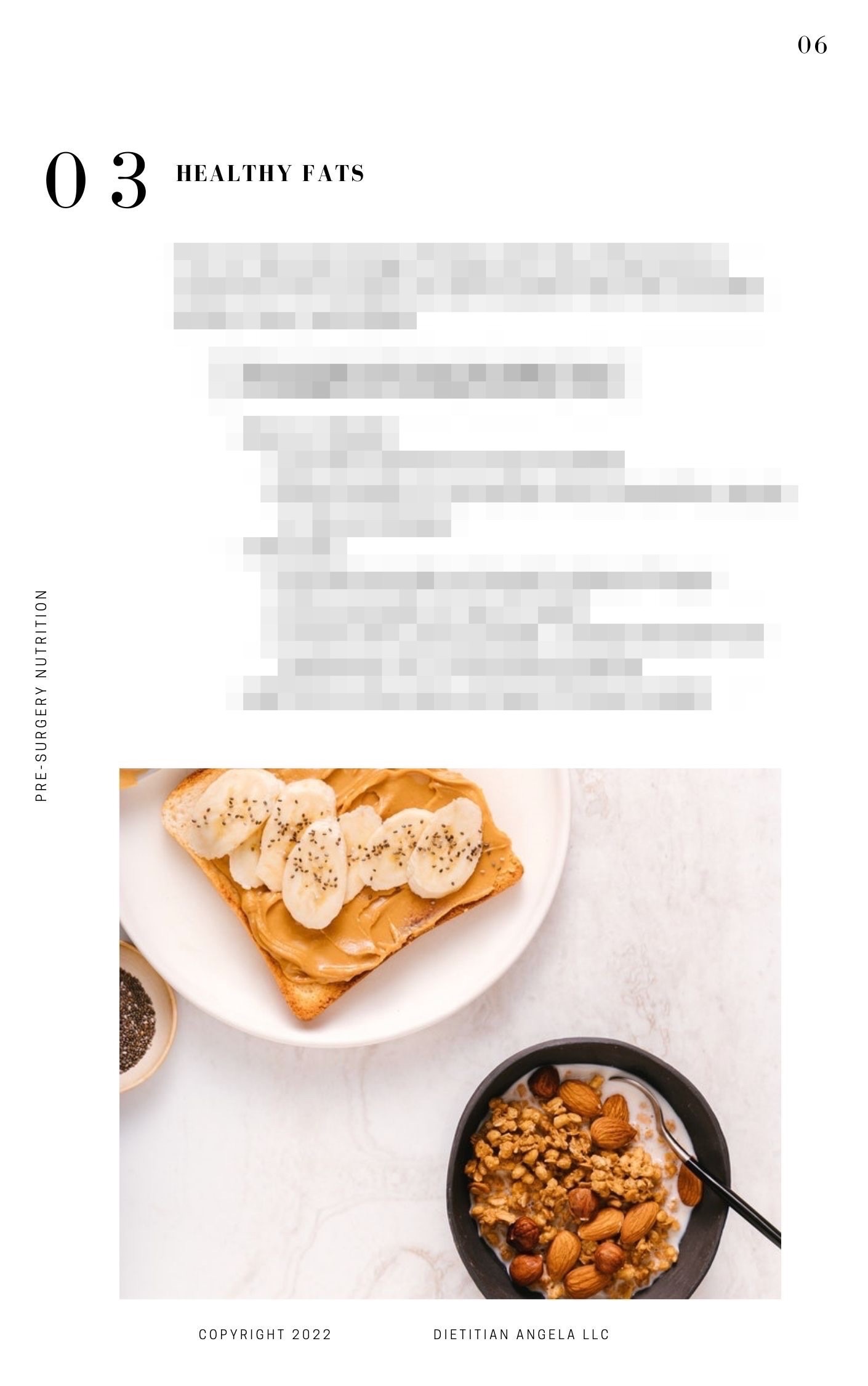 Pre-Surgery Nutrition - Well Resourced Dietitian