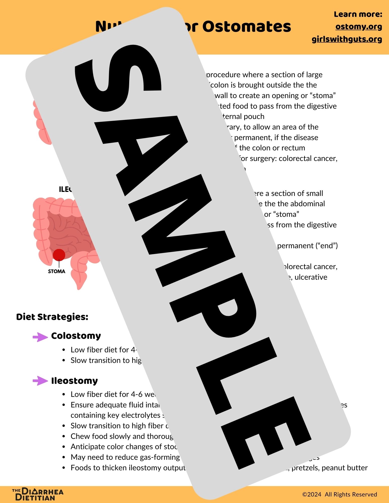 Nutrition for Ostomates (Free Resource) - Well Resourced Dietitian